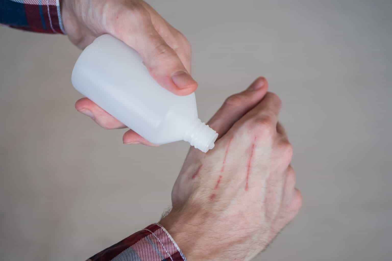 Uses for Hydrogen Peroxide | MomsWhoThink.com