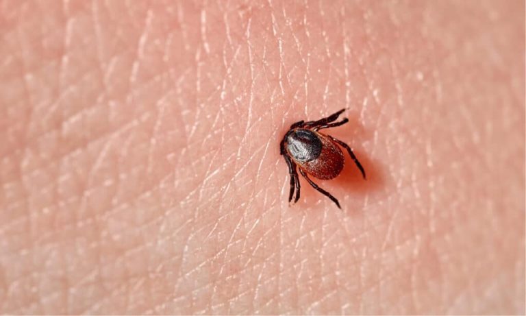 How to Check for Ticks on Your Children